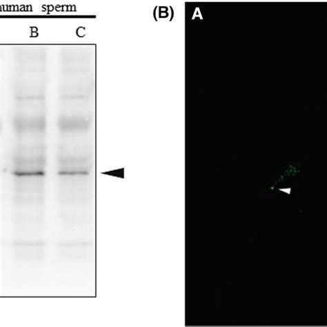 Detection Of Dopamine D2 Receptor D2dr Expression In Human Sperm A