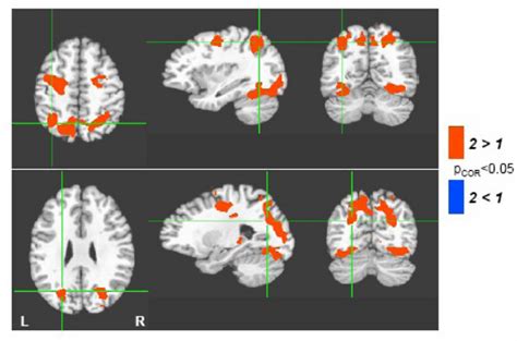 Main Effect Of Task Switching Regions With Greater Activation During