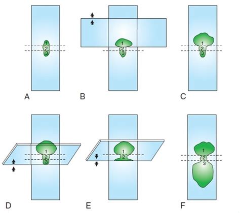 Vet1313 Cytology And Malignancy Flashcards Quizlet