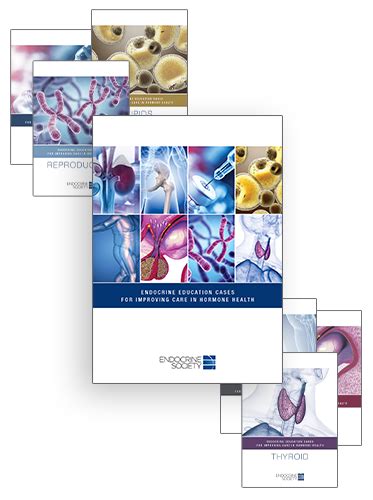 Updates To Education Cases Flashcards Endocrine Society
