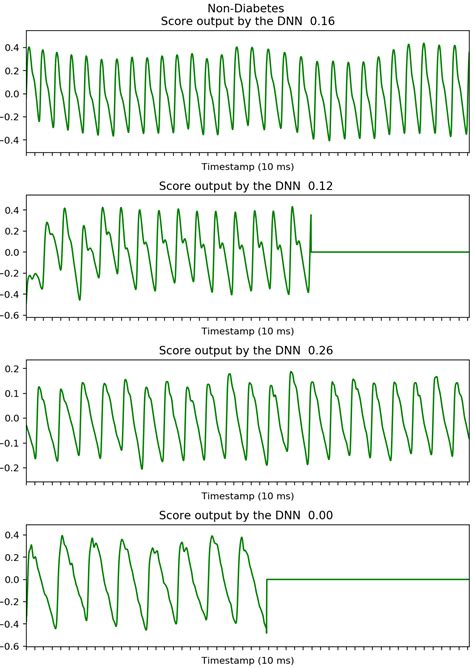 Ppg Diabetes Tison Lab Ucsf
