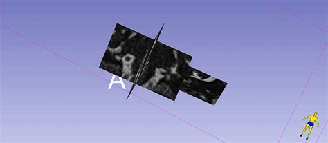 3d View Rendering Order Issue Support 3d Slicer Community