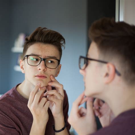 Tips For Acne Prone Skin Forefront Dermatology