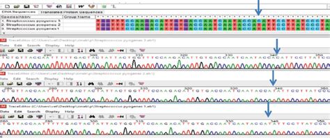 Multiple Sequence Alignment Analysis Show Tc Polymorphism In Sample