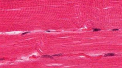 Exam Practice Questions Flashcards Quizlet