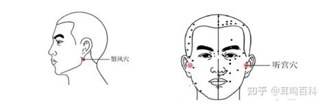 耳鸣怎样缓解？ 知乎