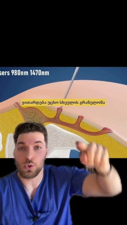 უმტკივნეულესი ცისტა სამედიცინო ექიმი მედიცინა Youtube