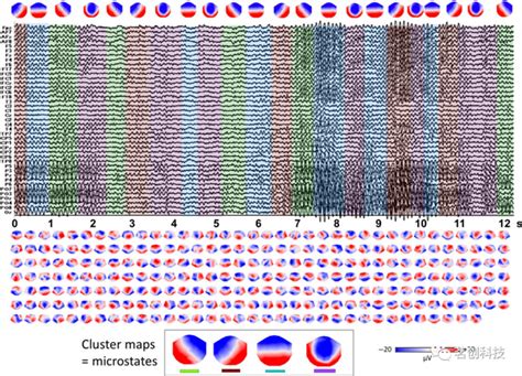 高分辨率EEG的空间分析 知乎