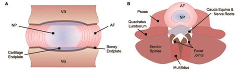 Schematic Of A Coronal And B Axial Crossections Of The Spinal