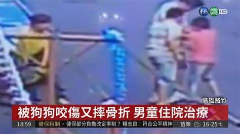 餵狗被當攻擊 小二男童遭撲咬骨折