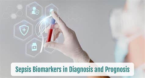 Evolution And Current Status Of Sepsis Bundles Sepsis Program Optimization