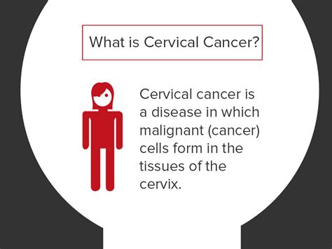 cervical cancer all you need to know baysection