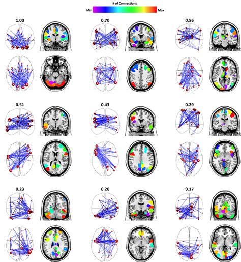 Dynamic Fmri Networks Predict Success In A Behavioral Weight Loss Program Among Older Adults