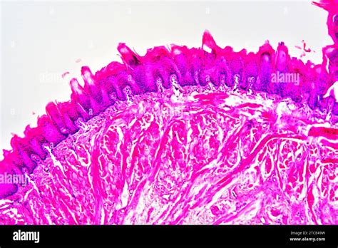 Tongue Section Showing Lingual Papillae Taste Buds Striated Muscles