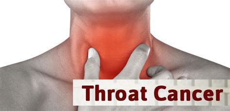 Throat Cancer Symptoms
