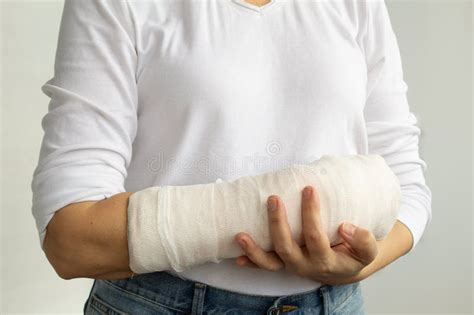 Close Up Of A Woman S Broken Arm In A Plaster Cast Accident Insurance