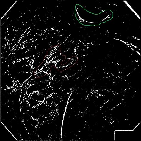 Removing Parallel Edges From Binary Image Signal Processing Stack