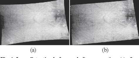 Figure 1 From Feasibility Of Using An Automatic Lens Distortion Correction Aldc Camera In A