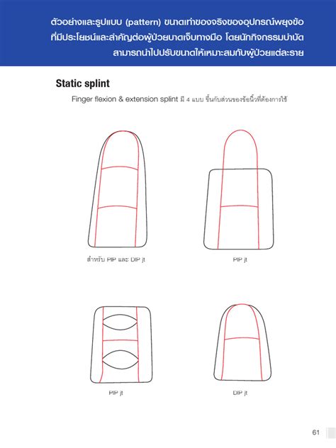 Pattern Splint Pdf