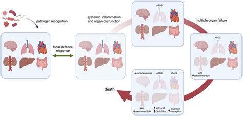 Schematic Presentation Of Progression Of Organ Loss In Sepsis In