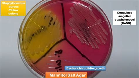 Mannitol Salt Agar Introduction Composition Preparation Colony Charact