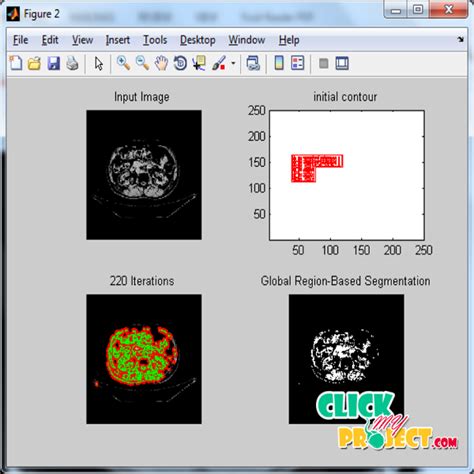 a bottom up approach for pancreas segmentation using cascaded superpixels and deep image patch