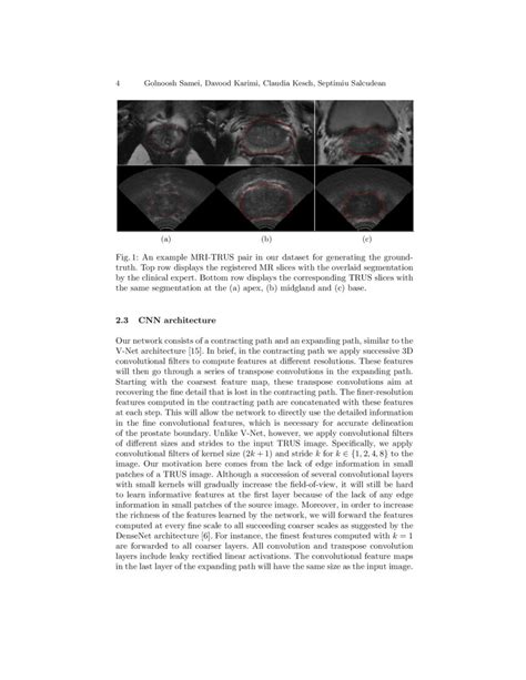 Automatic Segmentation Of The Prostate On 3d Trans Rectal Ultrasound Images Using Statistical
