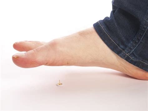 Neuropathic Pain Pins And Needles