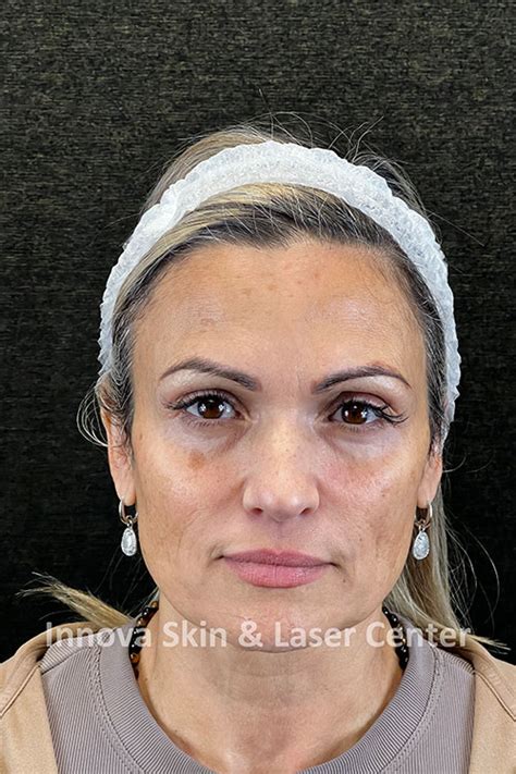 Beforeandafter Pdo Threads 04 Sleep And Wellness