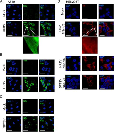 Subcellular Localization Of Uukv Hrtv And Sftsv Nss The Subcellular Download Scientific