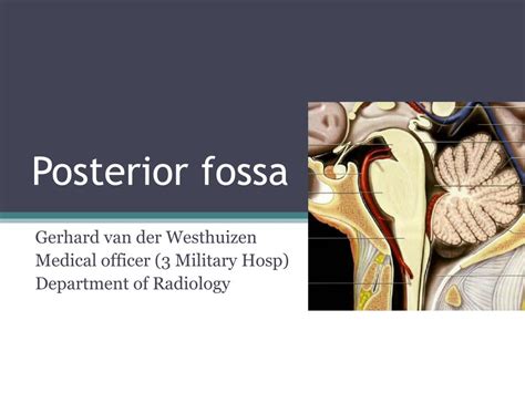 Ppt Posterior Fossa Powerpoint Presentation Free Download Id 2264046