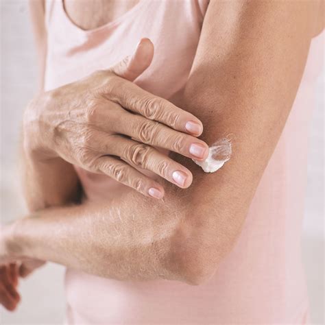 Cutaneous T Cell Lymphoma Nyu Langone Health