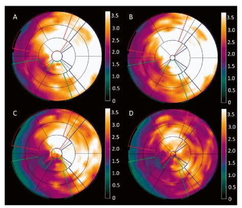 mbf polar plots of one patient s original scan in a compared to x 20