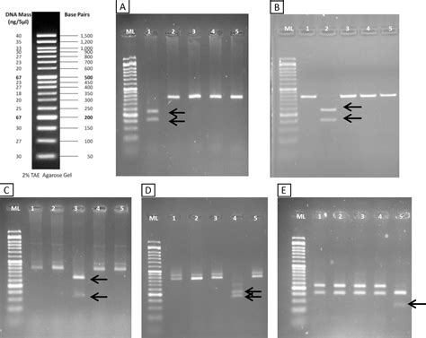 An Extremely Sensitive Nested Pcr Rflp Mitochondrial Marker For Detection And Identification Of