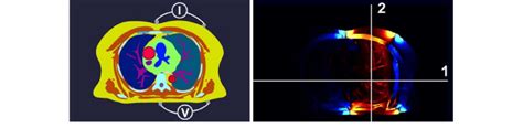Comparison Of The Segmentation Image And Sensitivity Map For Electrode