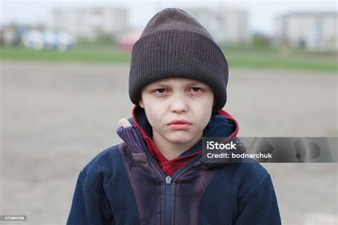 드라마틱 인물 사진 노숙자 남자아이 홈리스에 대한 스톡 사진 및 기타 이미지 홈리스 소년 아이 Istock