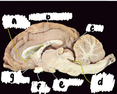 Sheep Brain Practical Flashcards Quizlet Sheep Brain Practical Flashcards Quizlet