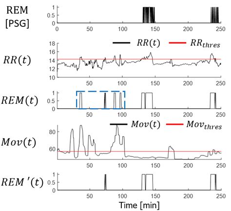 Fmcw Radar Based Rem Sleep Stage Detection Results A Case Of Normal Download Scientific