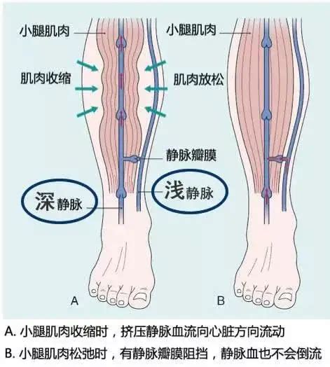 贵阳专业治疗静脉曲张的医院会复发吗疾病科普贵阳脉通血管医院【官方网站】贵阳脉通血管医院