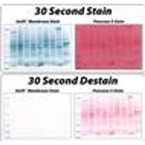 Sensitive Rapid Reversible Membrane Stain For Pvdf And Nitrocellulose