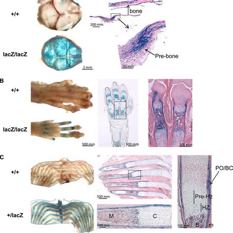 Activation Of The Runx2 P1 Promoter In Developing Bone Gal Staining Download Scientific