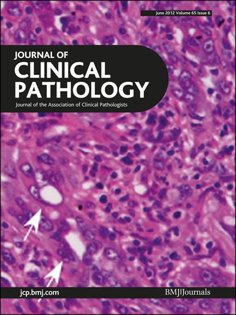 Uterine Tissue Discharge