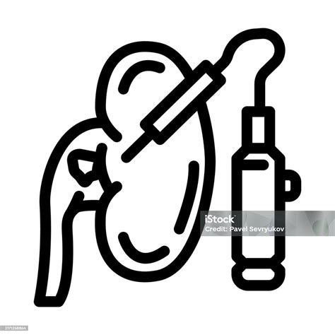 경피적 신장 절제술 수술 라인 아이콘 벡터 일러스트 레이 션 Robotic Surgery에 대한 스톡 벡터 아트 및 기타 이미지 Robotic Surgery 내시경