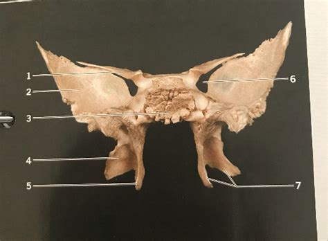 Sphenoid Bone Posterior View Diagram Quizlet