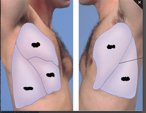 Health Assess Lung Fields Diagram Quizlet