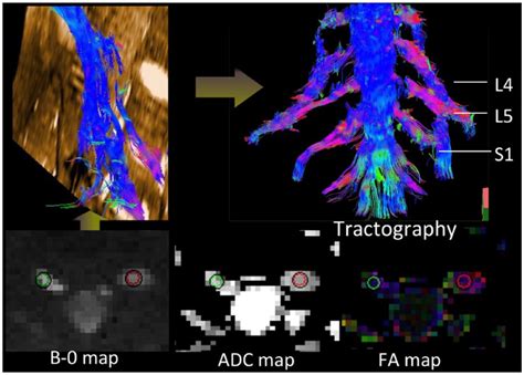 Schematic Diagram Showed The Measurement Of The DTI Parameters Download Scientific Diagram