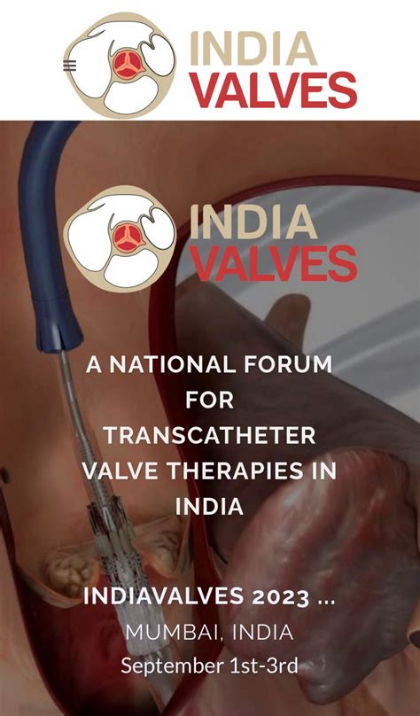 Joe Alkhatib On Linkedin Drashokseth Abbott Navitor Flexnav Tavi