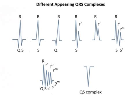 What Is An RSR Prime RSR Executive Electrocardiogram Education