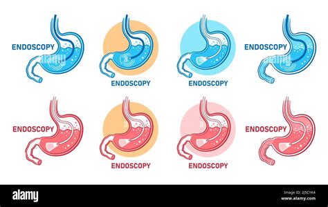 Gastric Ulcer Endoscopy Cut Out Stock Images And Pictures Alamy