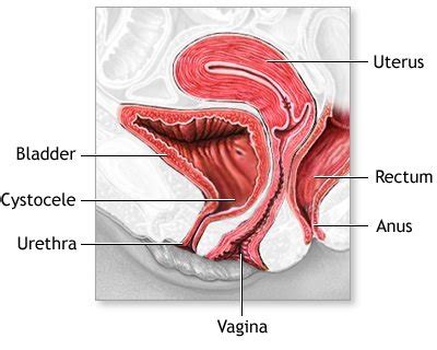 Anterior Posterior Repair Colporrhaphy Price In India Best Hospitals In India